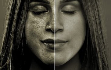 Colin Ruff, MD | U.S. Dermatology Partners Leawood, Kansas