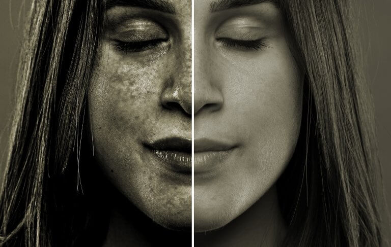 Adam Luber, MD | Southwest Skin Specialist | U.S. Dermatology Partners