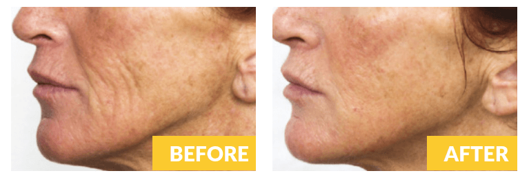 Cosmetic Specials | Center for Aesthetic and Laser Medicine Plano