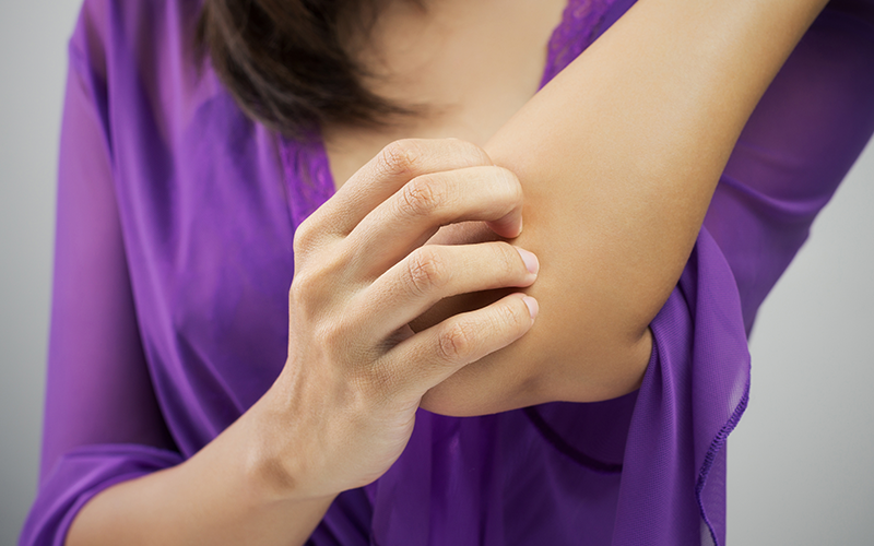 What Causes the Ringworm Rash? – U.S. Dermatology Partners | Blog