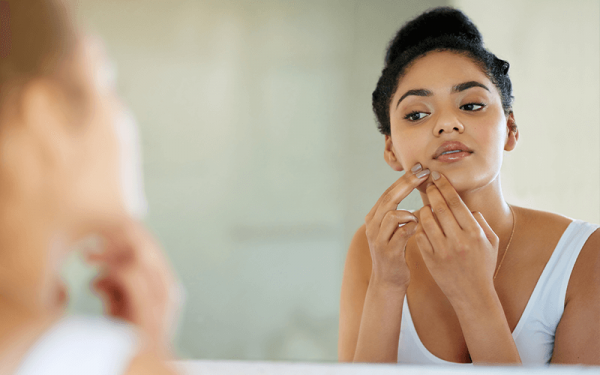 5 Tips To Help Control Hormonal Acne U S Dermatology Partners