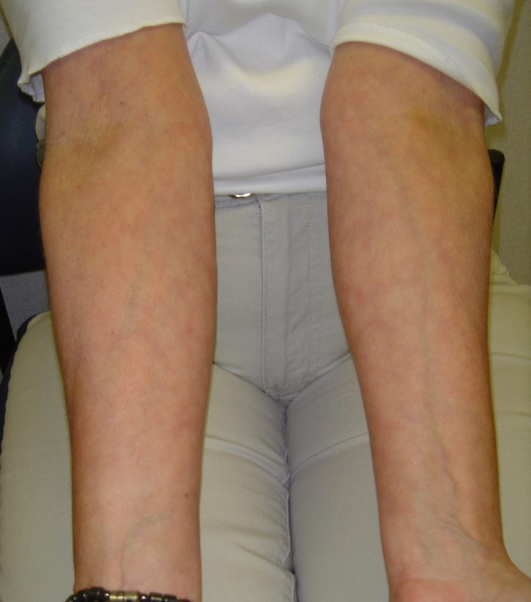 How COVID-19 Affects the Skin | U.S. Dermatology Partners