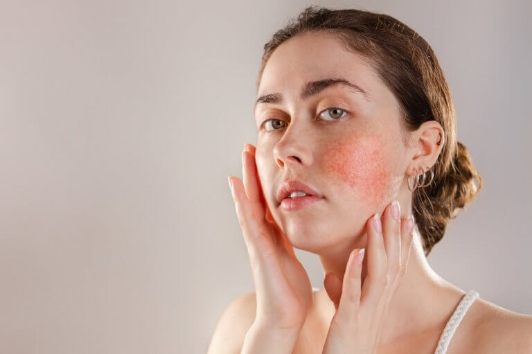 Why Do Pimples Hurt So Much? (And How to Stop the Pain)