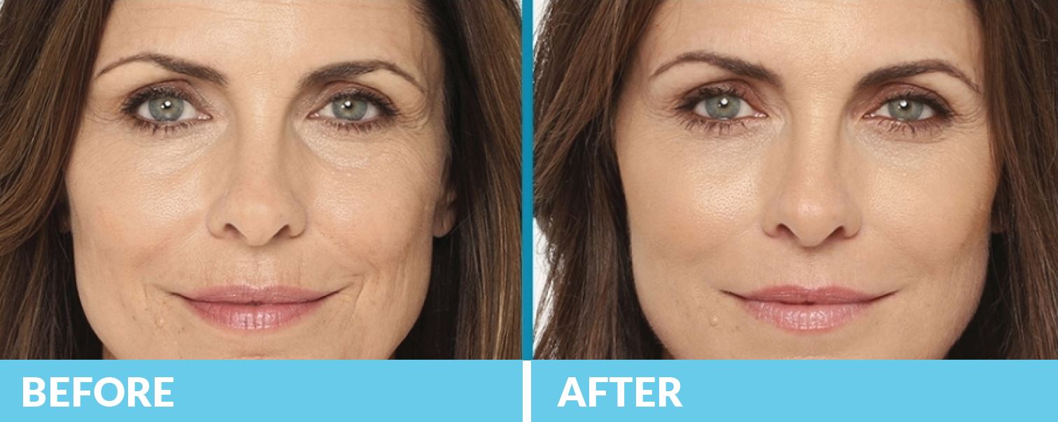 Cosmetic Specials | U.S. Dermatology Partners Sugar Land