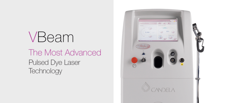VBeam Laser Treatment | U.S. Dermatology Partners