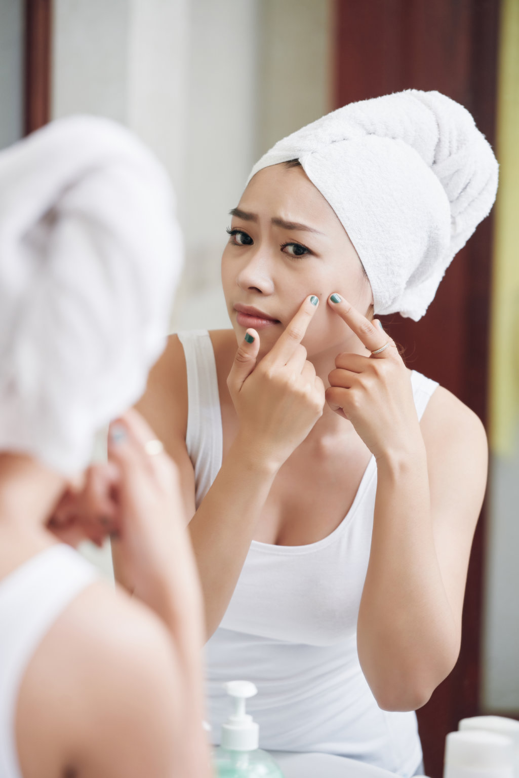 Skincare FAQs | Popping Pimples: Is it bad for your skin?
