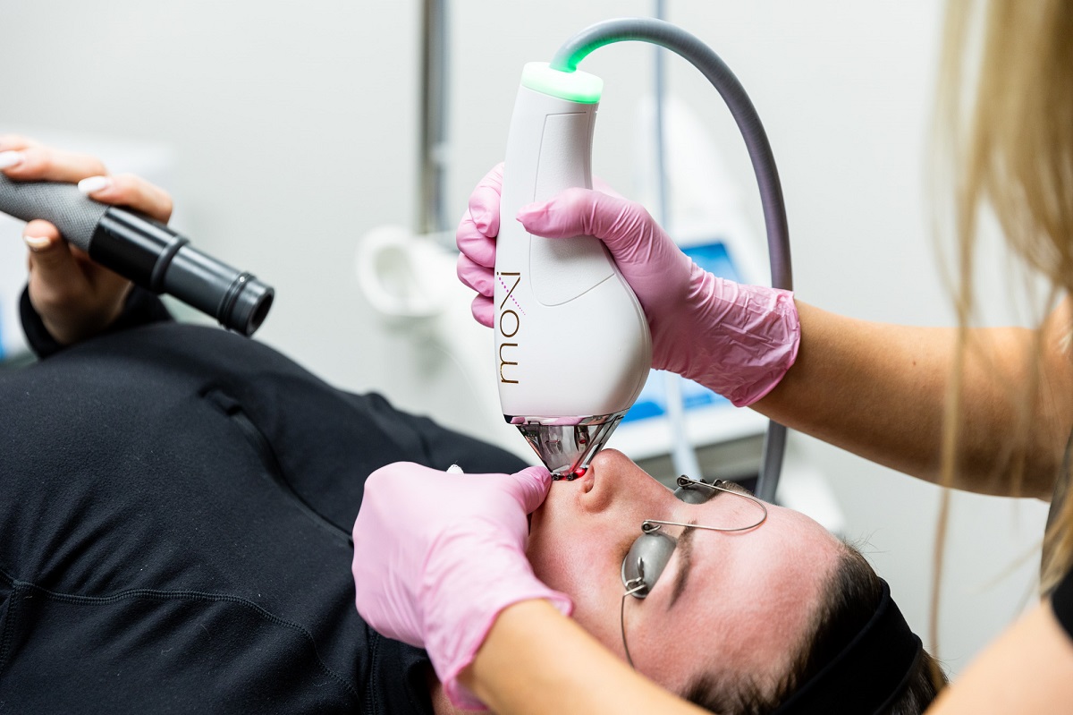MOXI Laser Treatment | U.S. Dermatology Partners