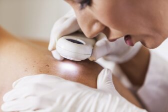 What Happens if Squamous Cell Carcinoma Is Left Untreated? - U.S ...