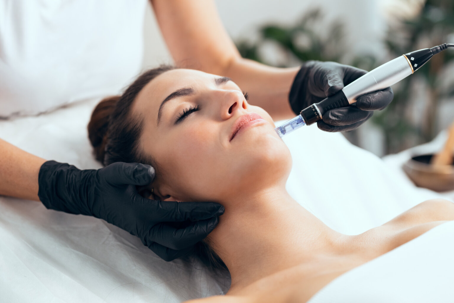 Microneedling: A Solution for Collagen Loss - U.S. Dermatology Partners